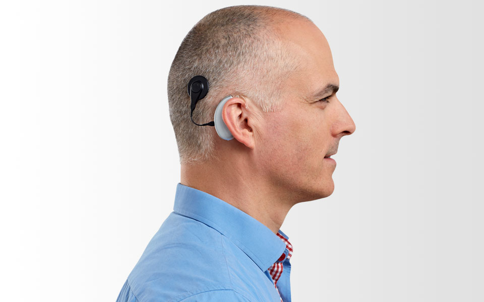 Cochlear implantation step by step | Oticon Medical