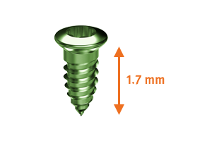 Proven and safe - the Neuro System unique screw fixation | Oticon Medical