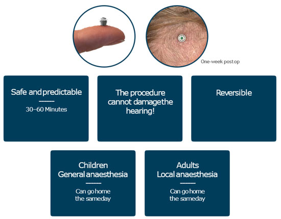 Bone conduction support