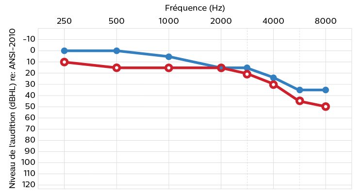 Comprendre la perte auditive et comment protéger l'audition | Appareils ...