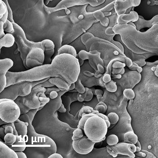 Bone bonding - the next level of osseointegration