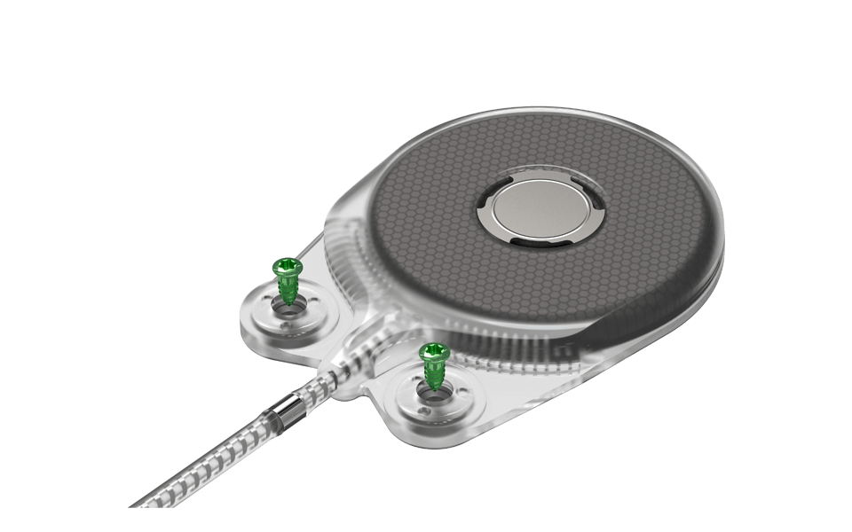 Neuro Zti implant | Compact & robust | Oticon Medical