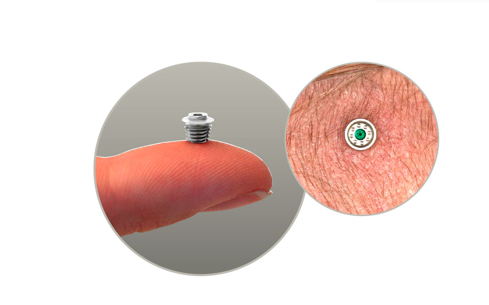 Bone conduction support