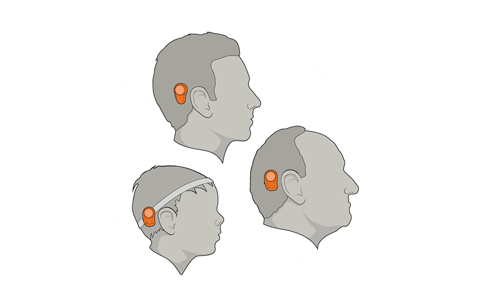 Bone conduction step-by-step